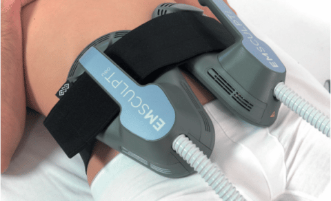 Abdomen Emsculpt NEO Treatment at Shape Med Centers