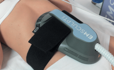 Abdomen Emsculpt NEO Treatment at Shape Med Centers