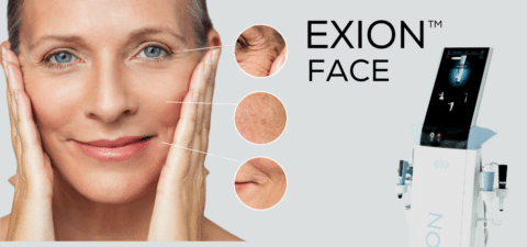 EXION Face treatments at Shape Med Centers in Charlotte