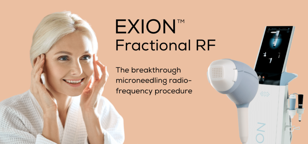 EXION RF Microneedling with AI | Shape Med Centers