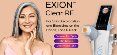 EXION Clear RF at Shape Med Centers in Charlotte